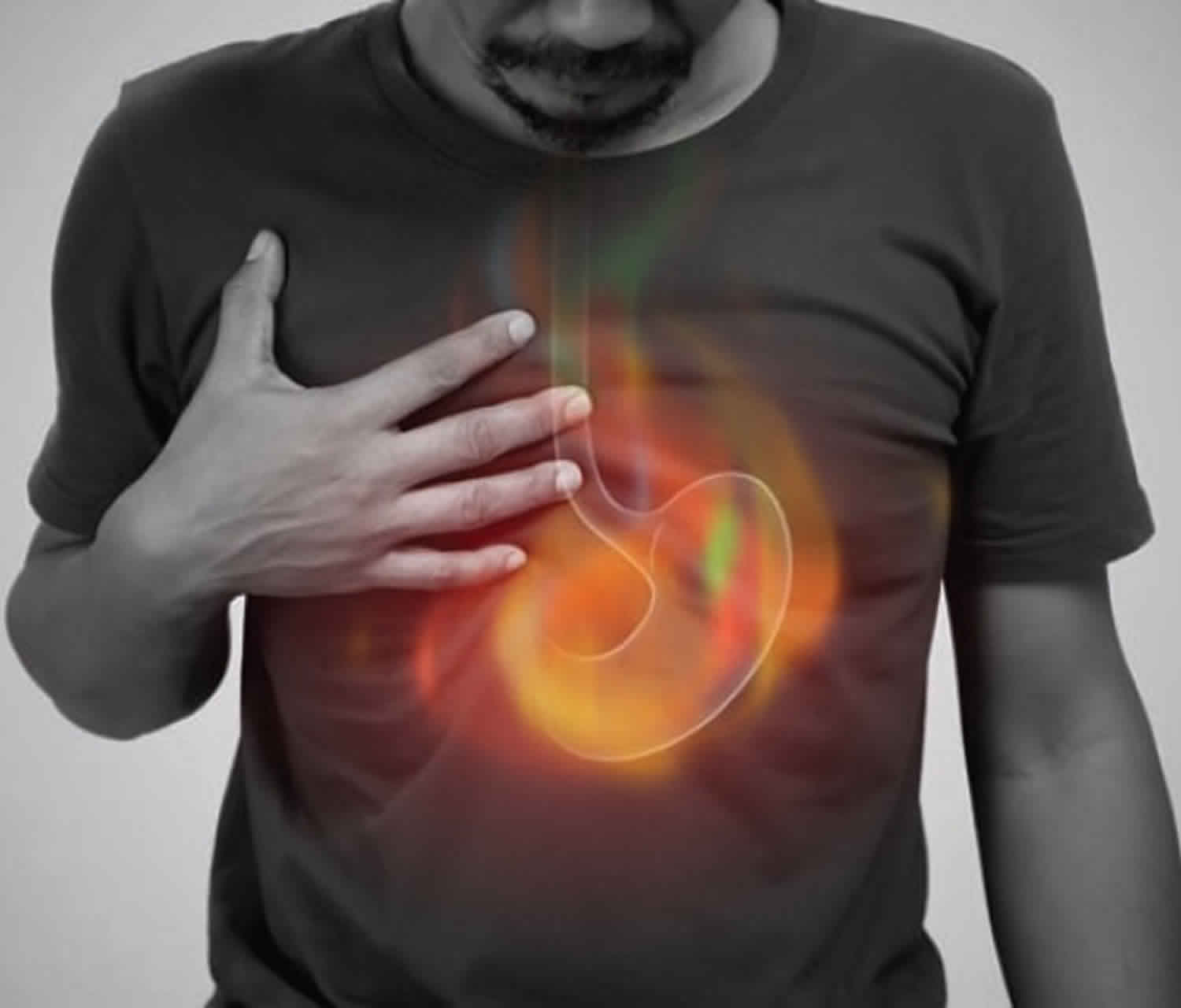 Heartburn: Why It Happens & How to Untangle the Roots | True Resilience ...